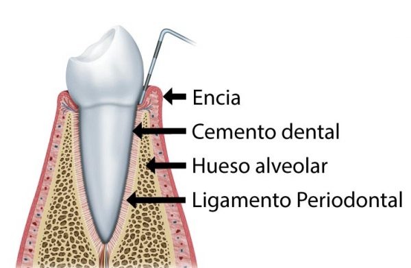 Tratamientos avanzados de periodoncia en Bizkaia